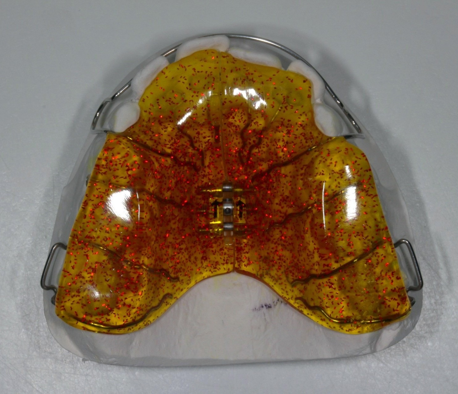 Uitneembare apparatuur :: Orthodontie Deboosere