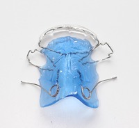 Buitenbeugel :: Orthodontie Deboosere