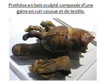 1- Des premières prothèses à la flex foot cheetah. :: Tpe-la-prothese ...