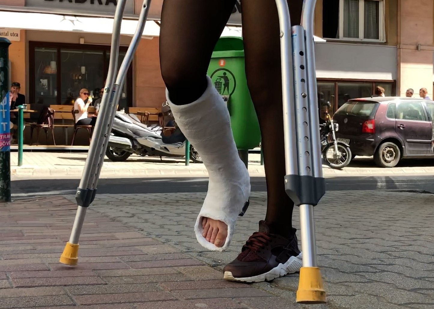 Lower short leg plaster cast with heel (slwc) :: Plastertesters-info