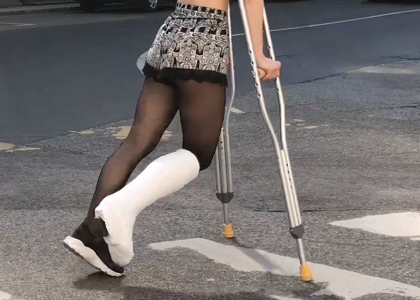 Lower Short Leg Plaster Cast With Heel Slwc Plastertesters Info