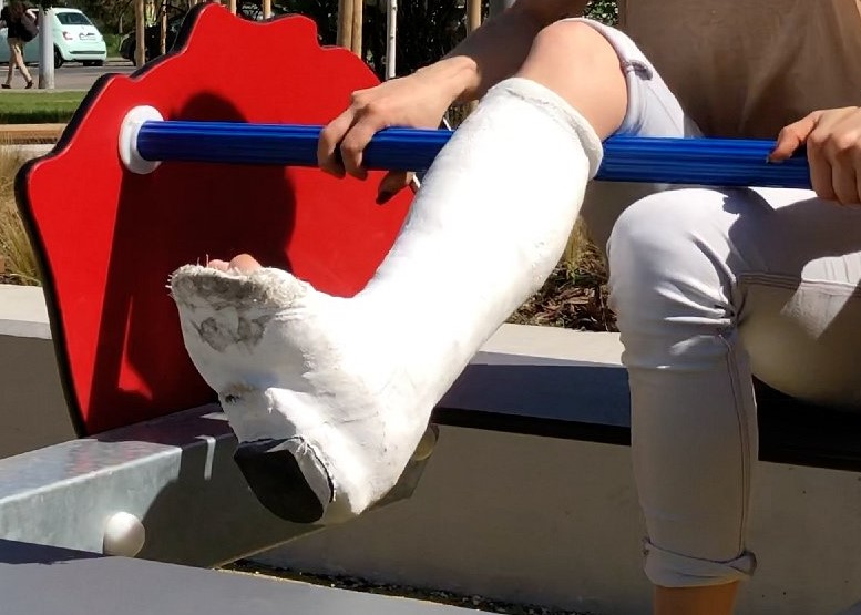 Lower short leg plaster cast with heel (slwc) :: Plastertesters-info
