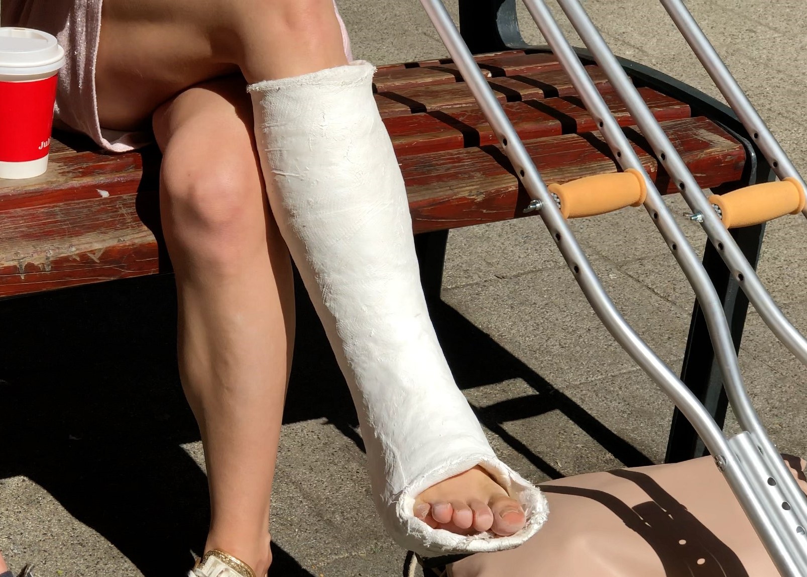 Lower Short Leg Plaster Cast With Heel Slwc Plastertesters Info