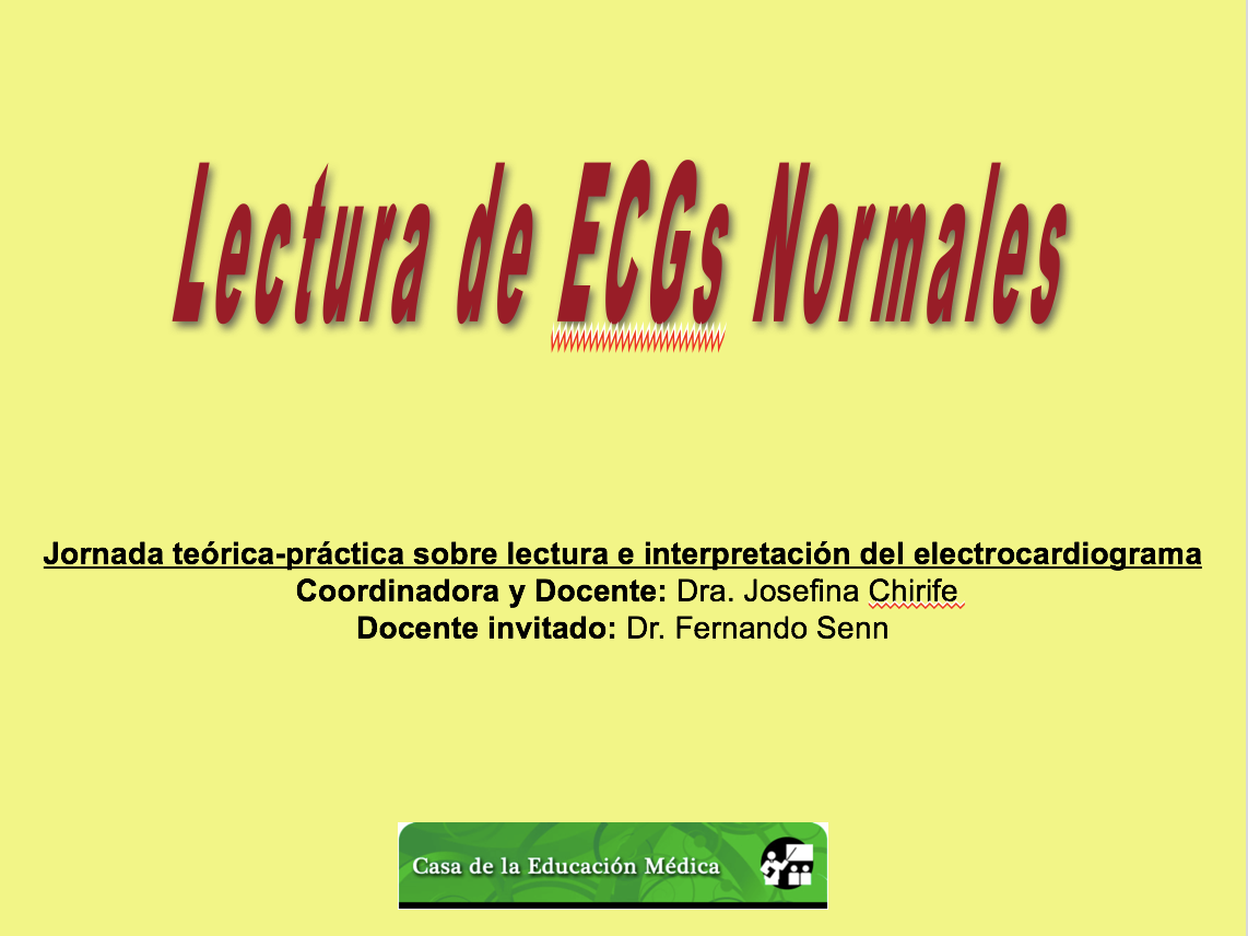Lectura de ECG Normal